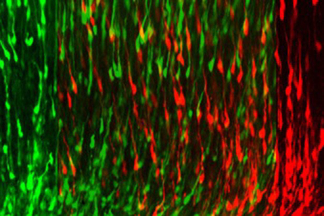 Synaptic plasticity in intellectual disabilities | Research ...